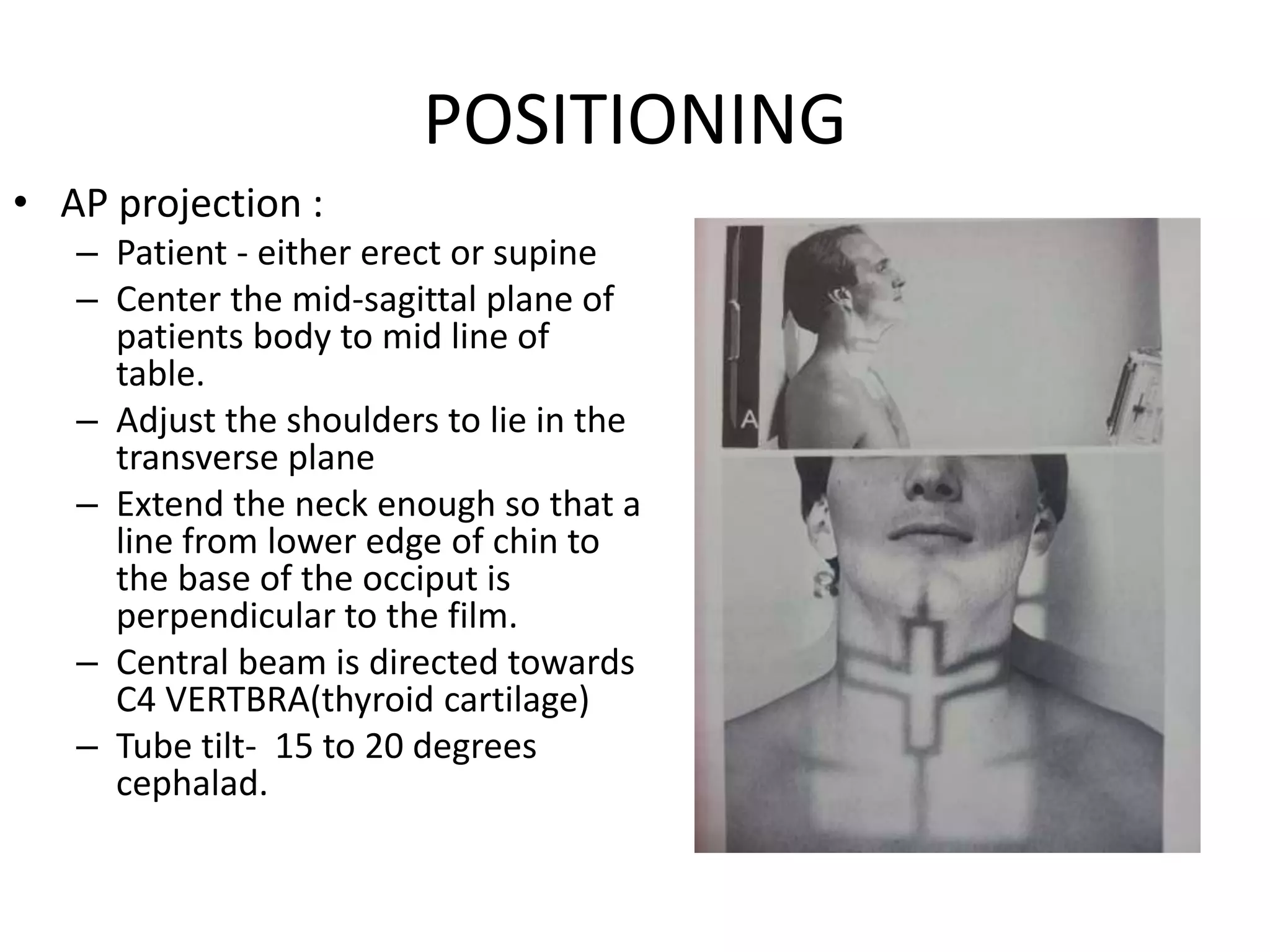 X ray c-spine | PPTX