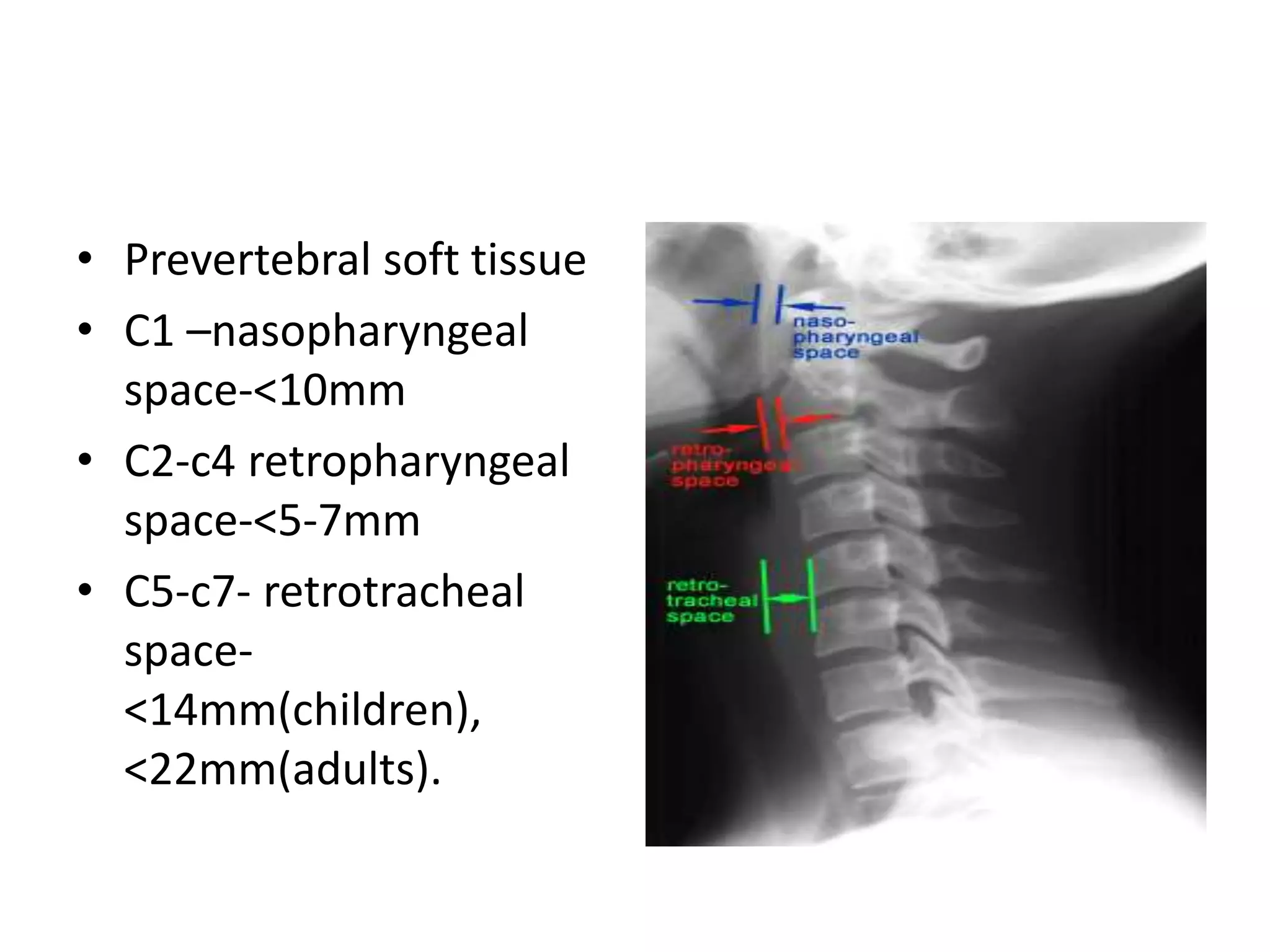 X ray c-spine | PPTX | Death, Injury, or Military Conflict | Sensitive Topics
