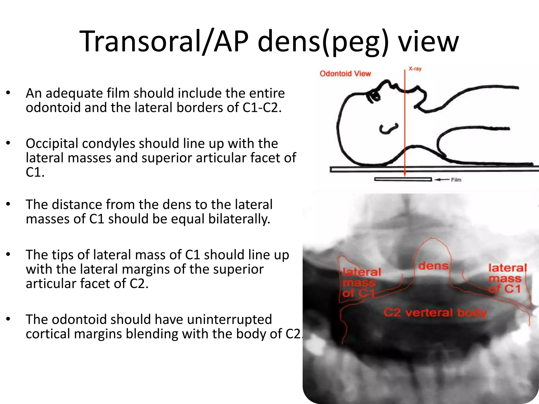 X ray c-spine | PPTX