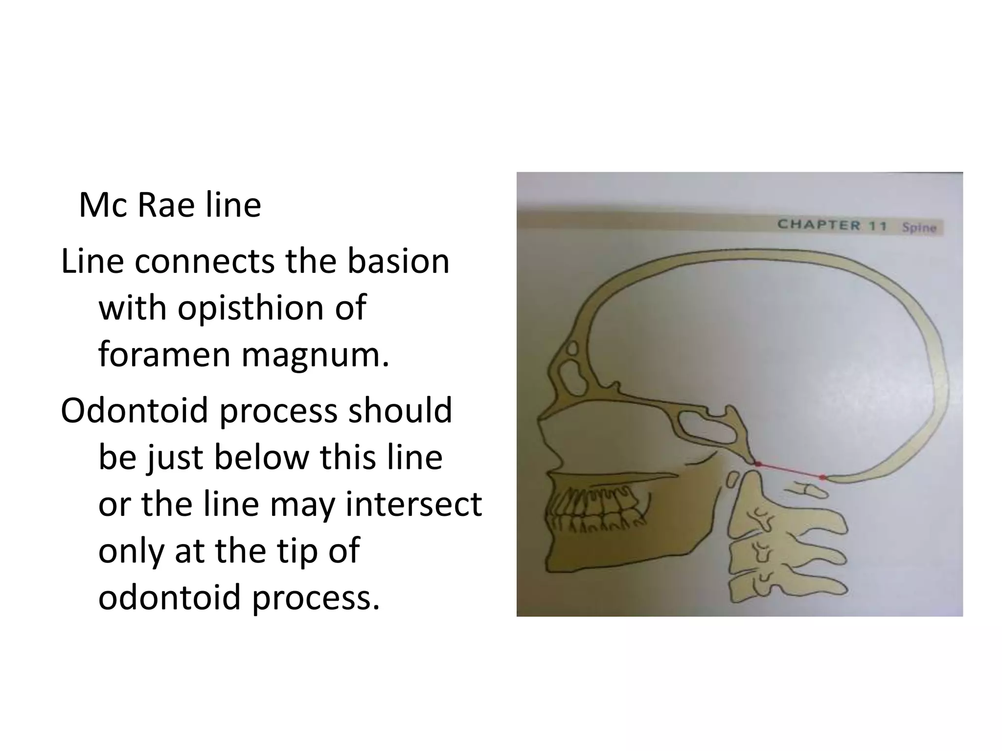X ray c-spine | PPTX