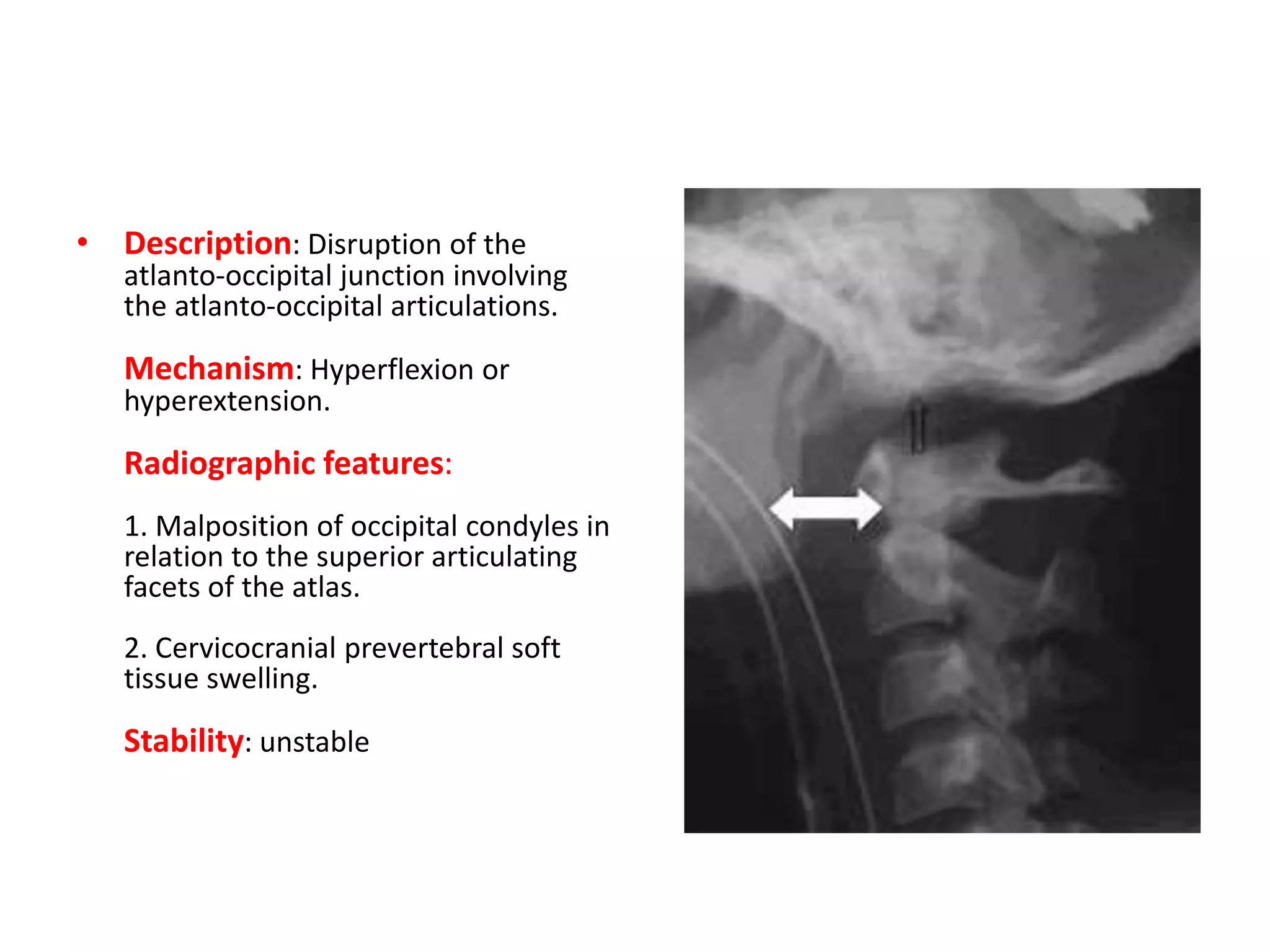 X ray c-spine | PPTX