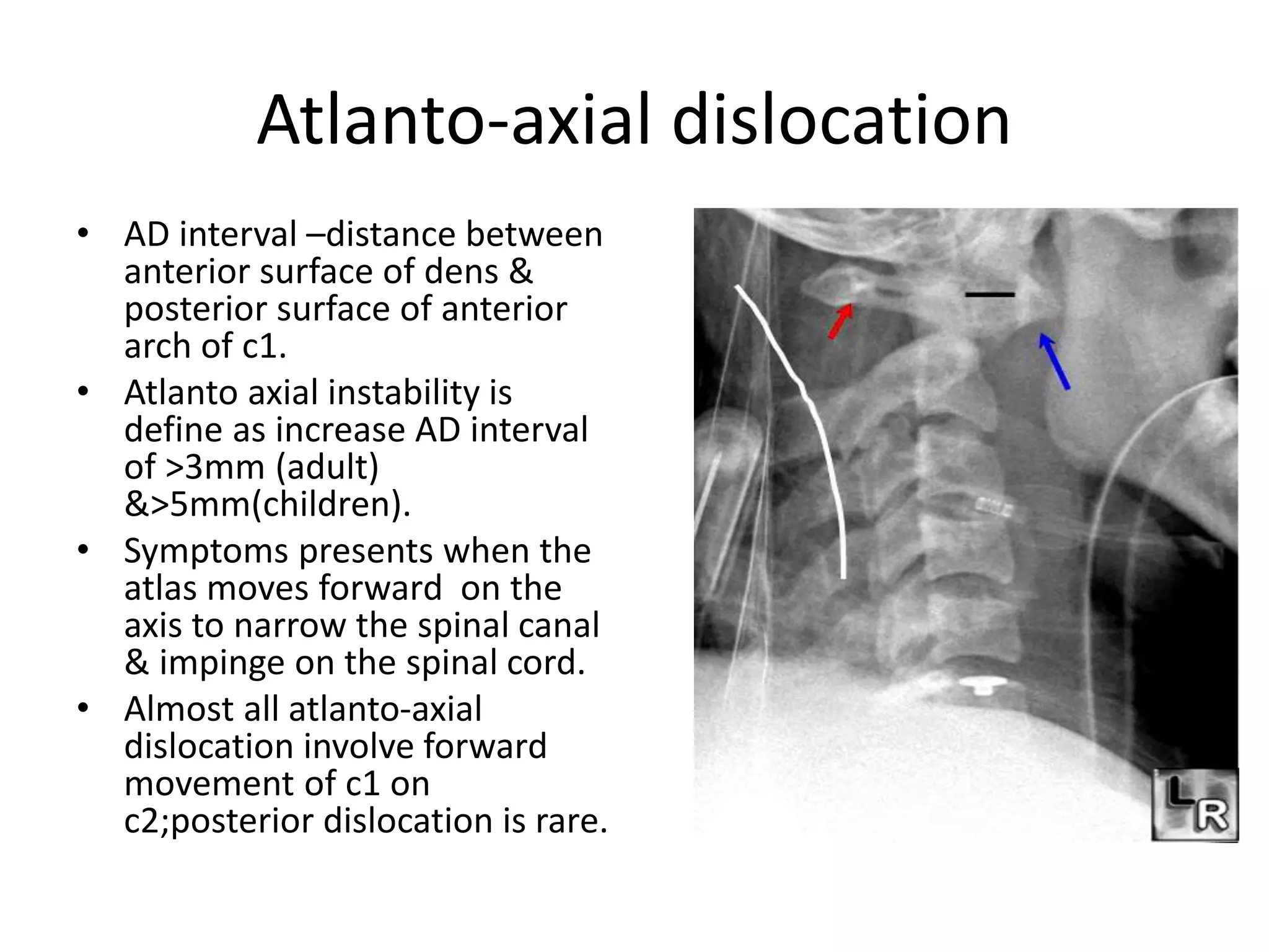 X ray c-spine | PPTX