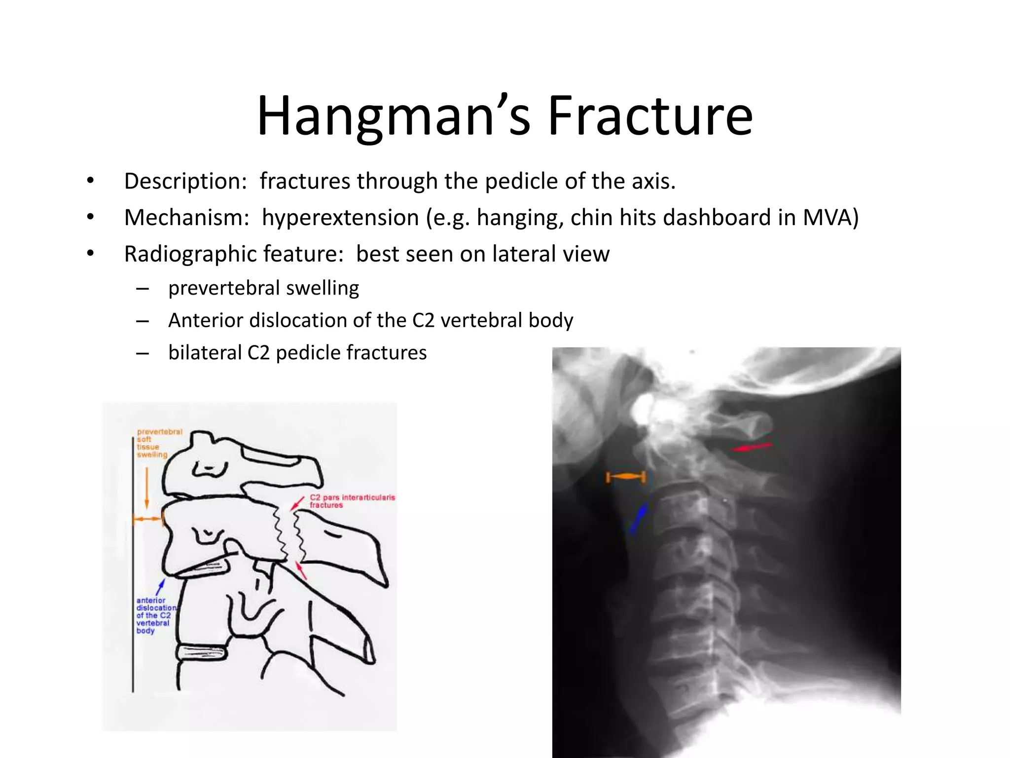 X ray c-spine | PPTX