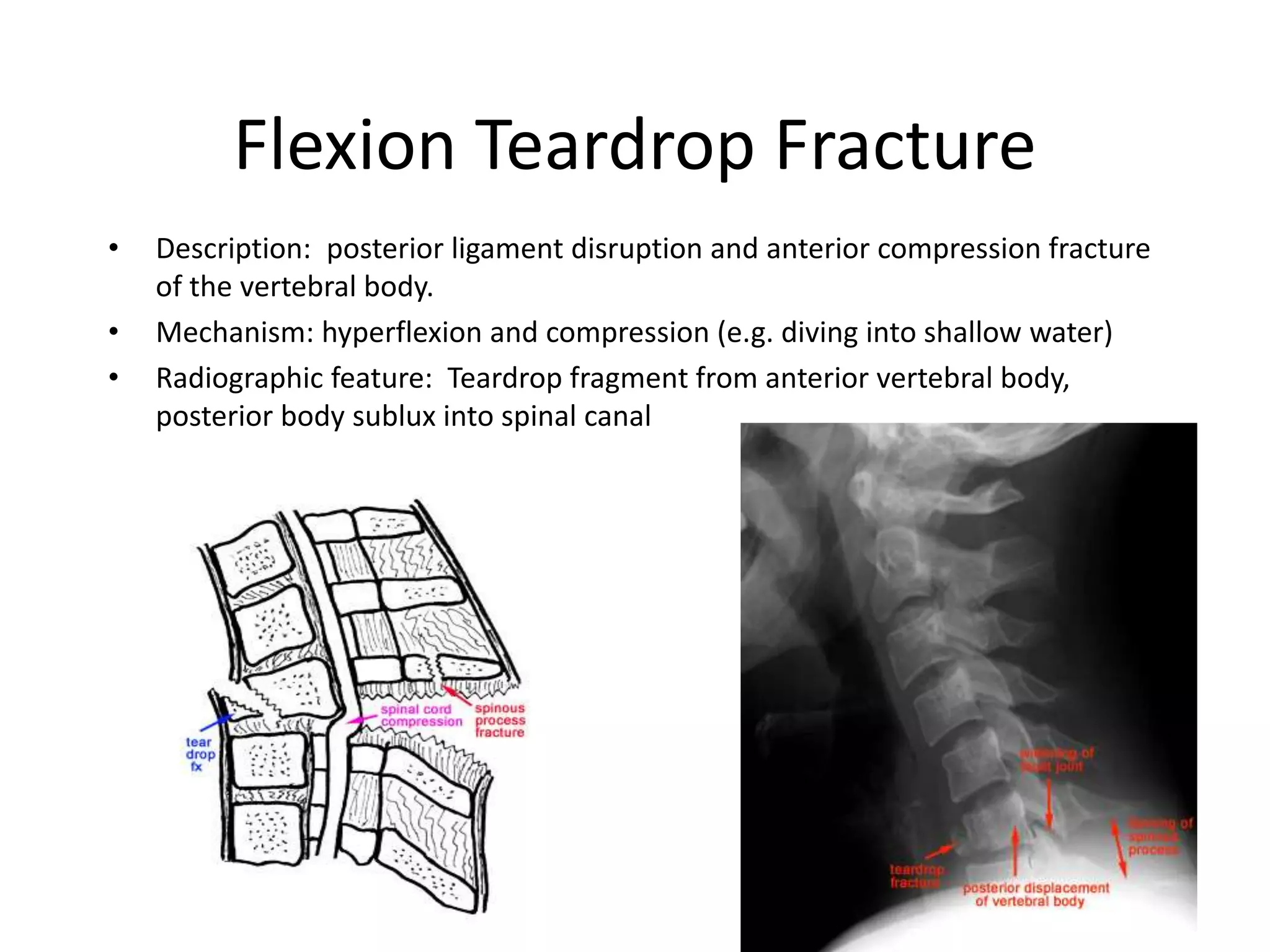 X ray c-spine | PPTX