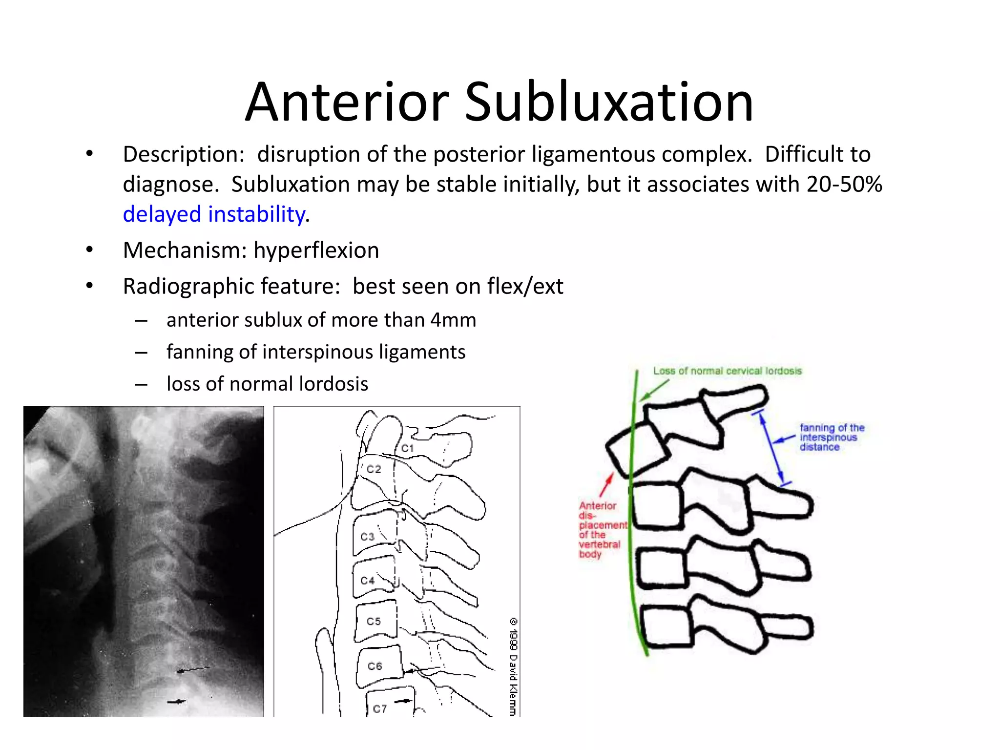 X ray c-spine | PPTX