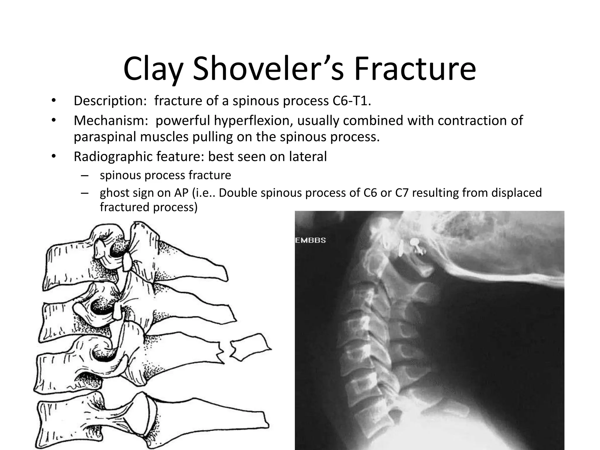 X ray c-spine | PPTX
