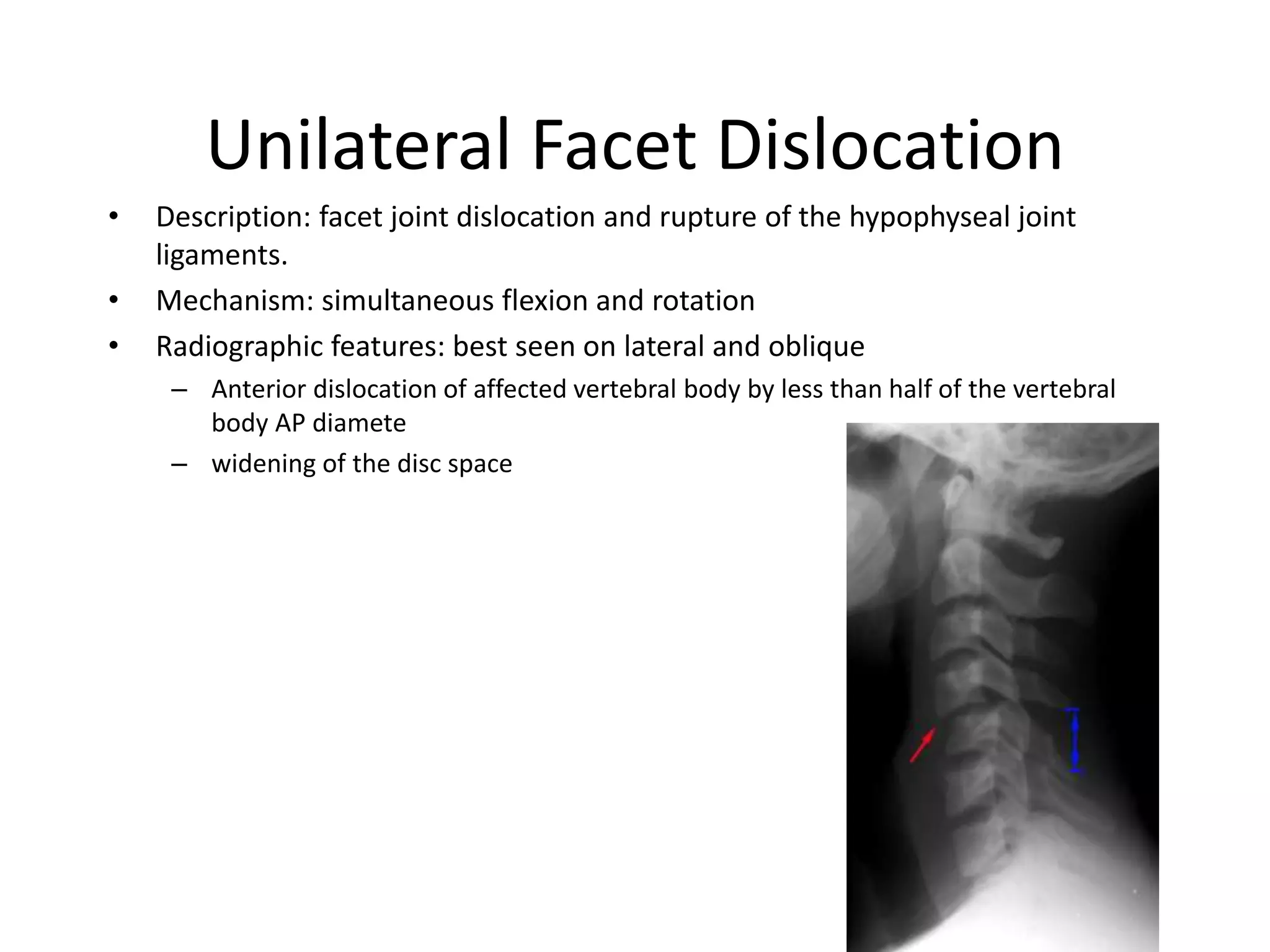 X ray c-spine | PPTX