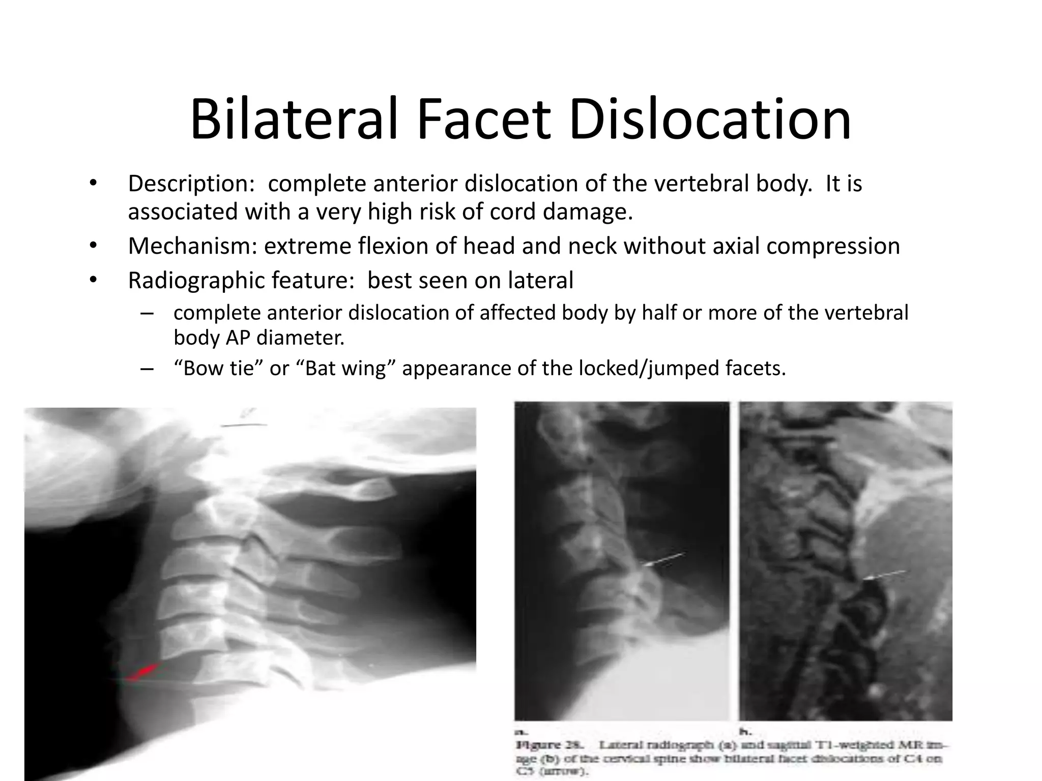 X ray c-spine | PPTX