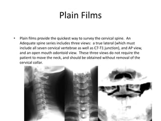 X ray c-spine | PPTX