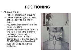 X ray c-spine | PPTX
