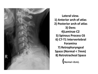 X ray c-spine | PPTX