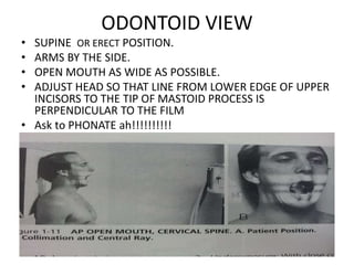 X ray c-spine | PPTX