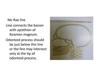X ray c-spine | PPTX