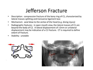 X ray c-spine | PPTX