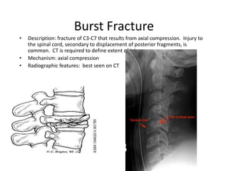 X ray c-spine | PPTX