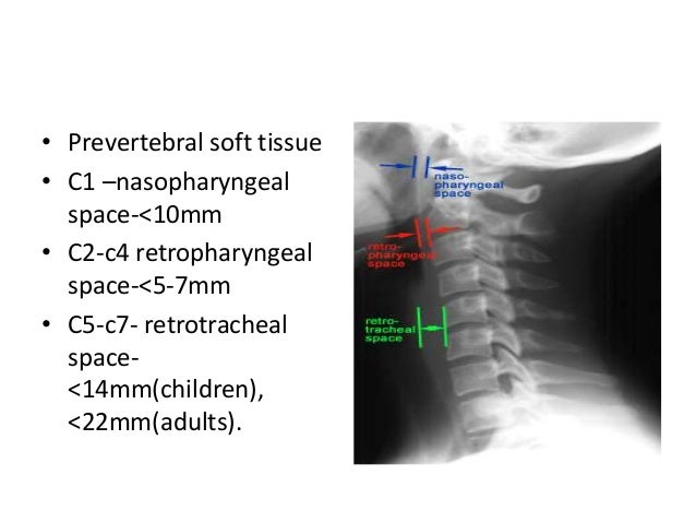 X ray c-spine