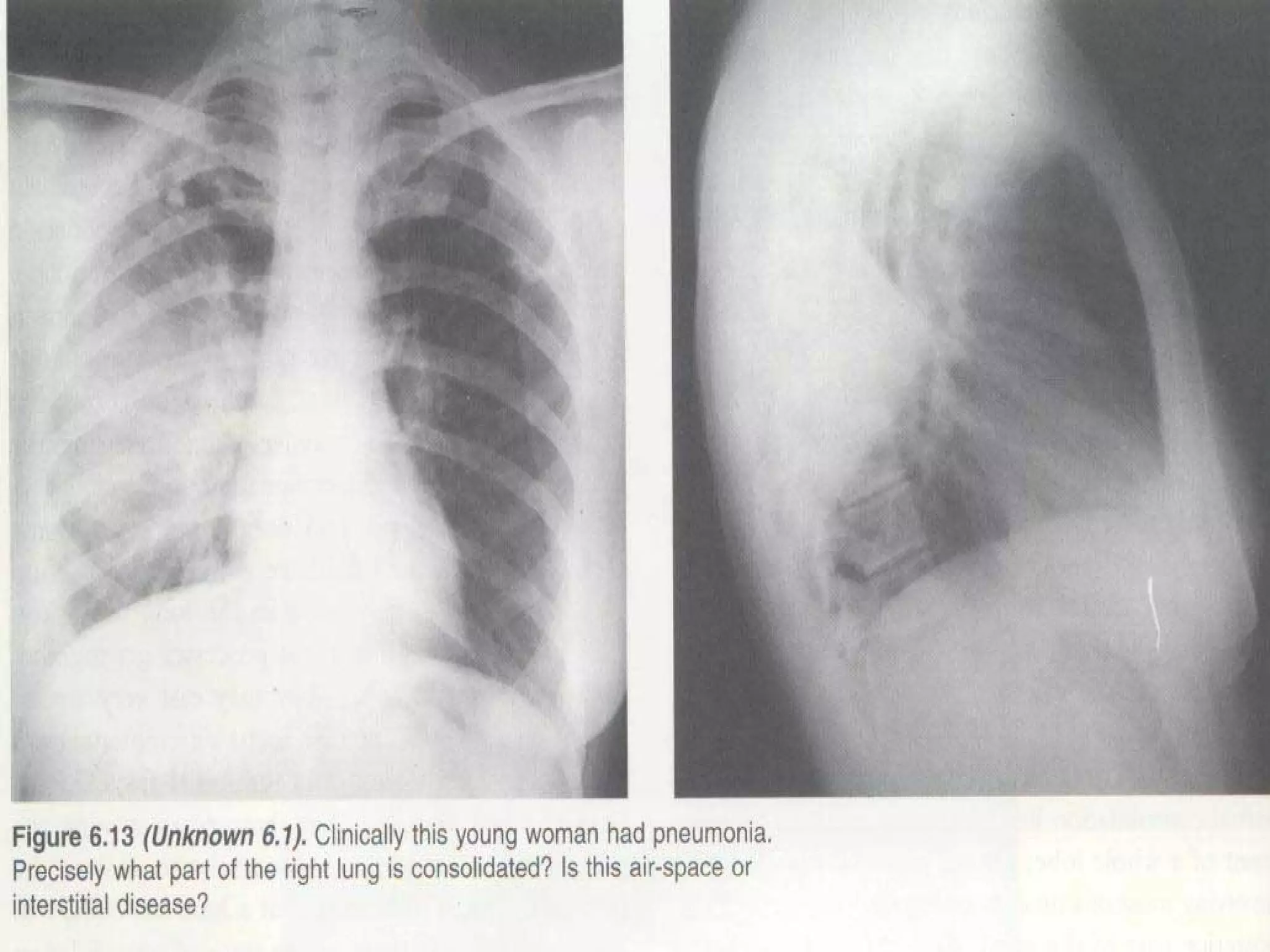 X-RAY DADA - (SISTEM RESPIRASI) | PPT