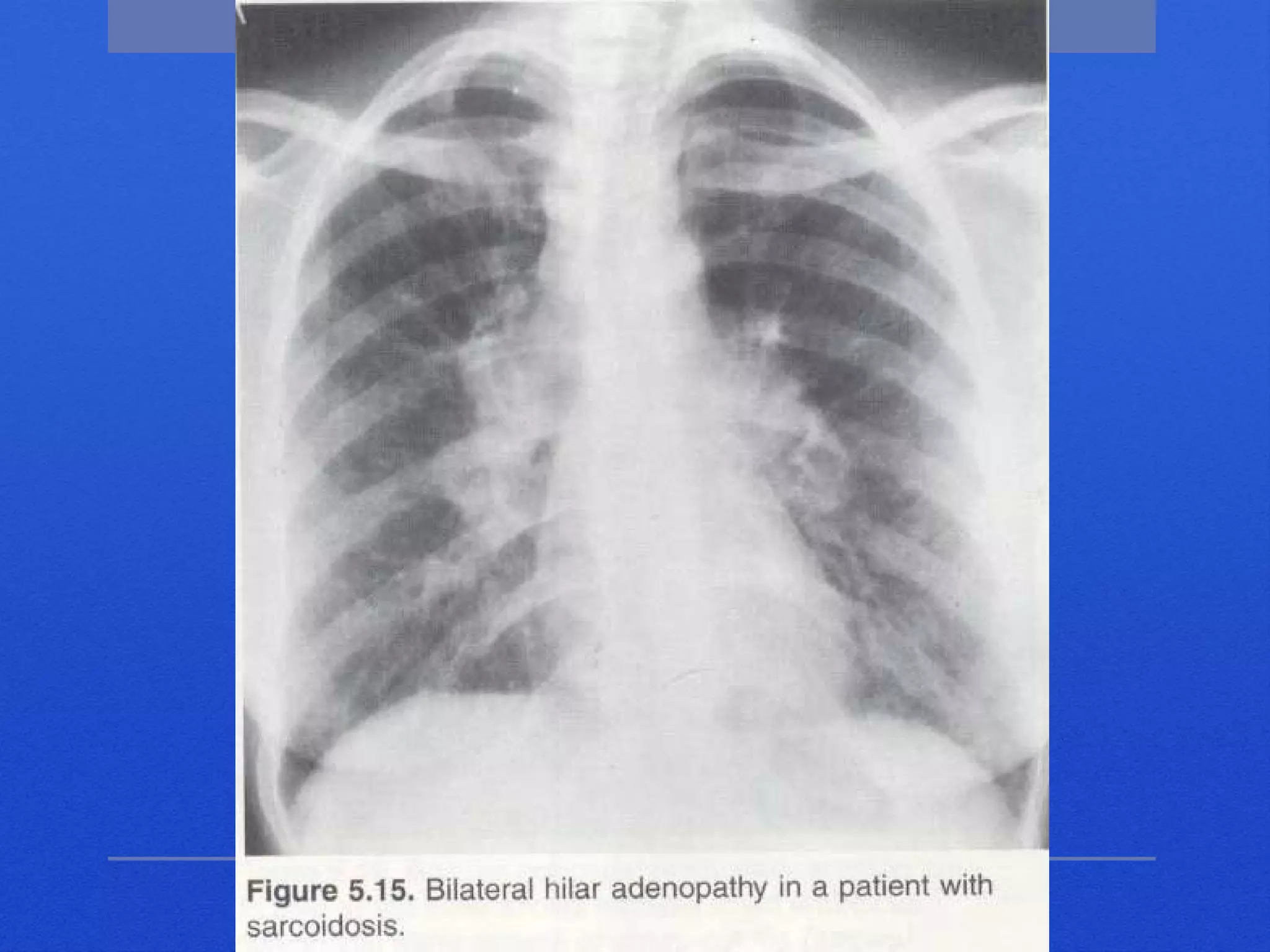 X-RAY DADA - (SISTEM RESPIRASI) | PPT