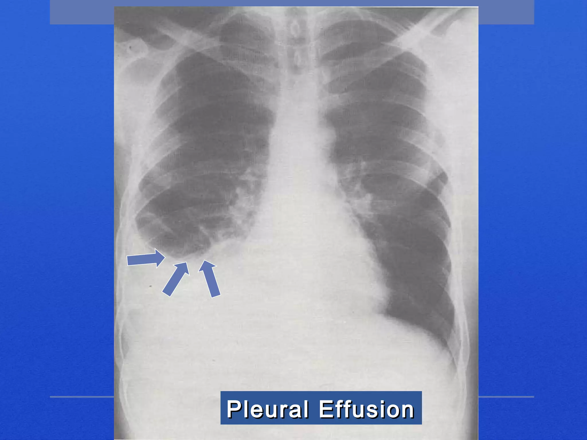 X-RAY DADA - (SISTEM RESPIRASI) | PPT