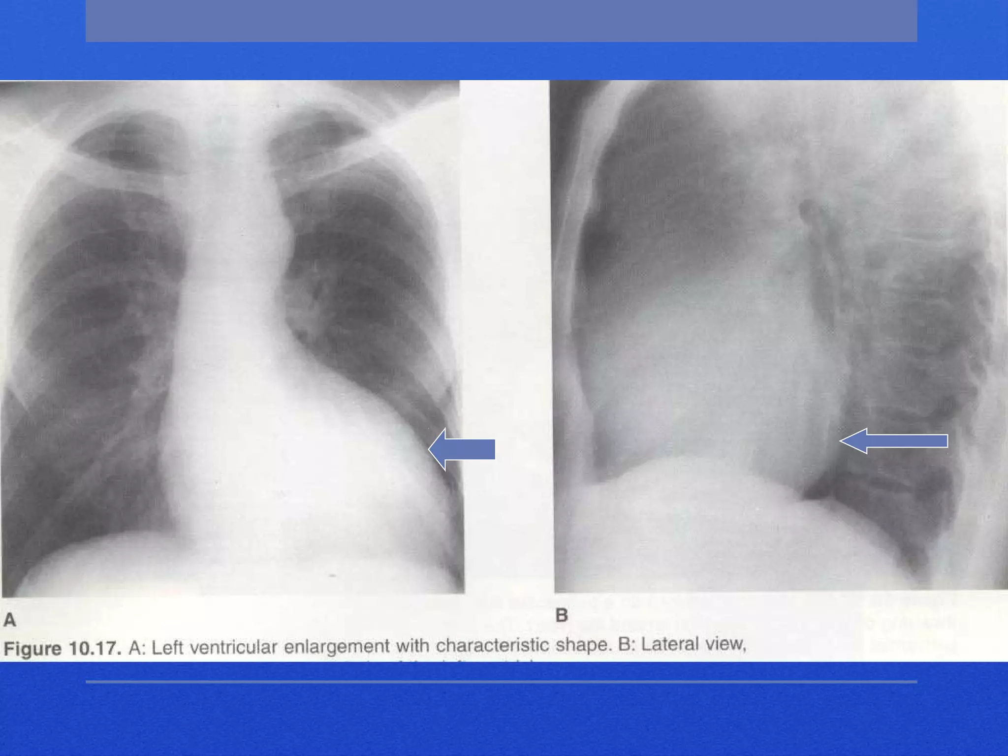X-RAY DADA - (SISTEM RESPIRASI) | PPT