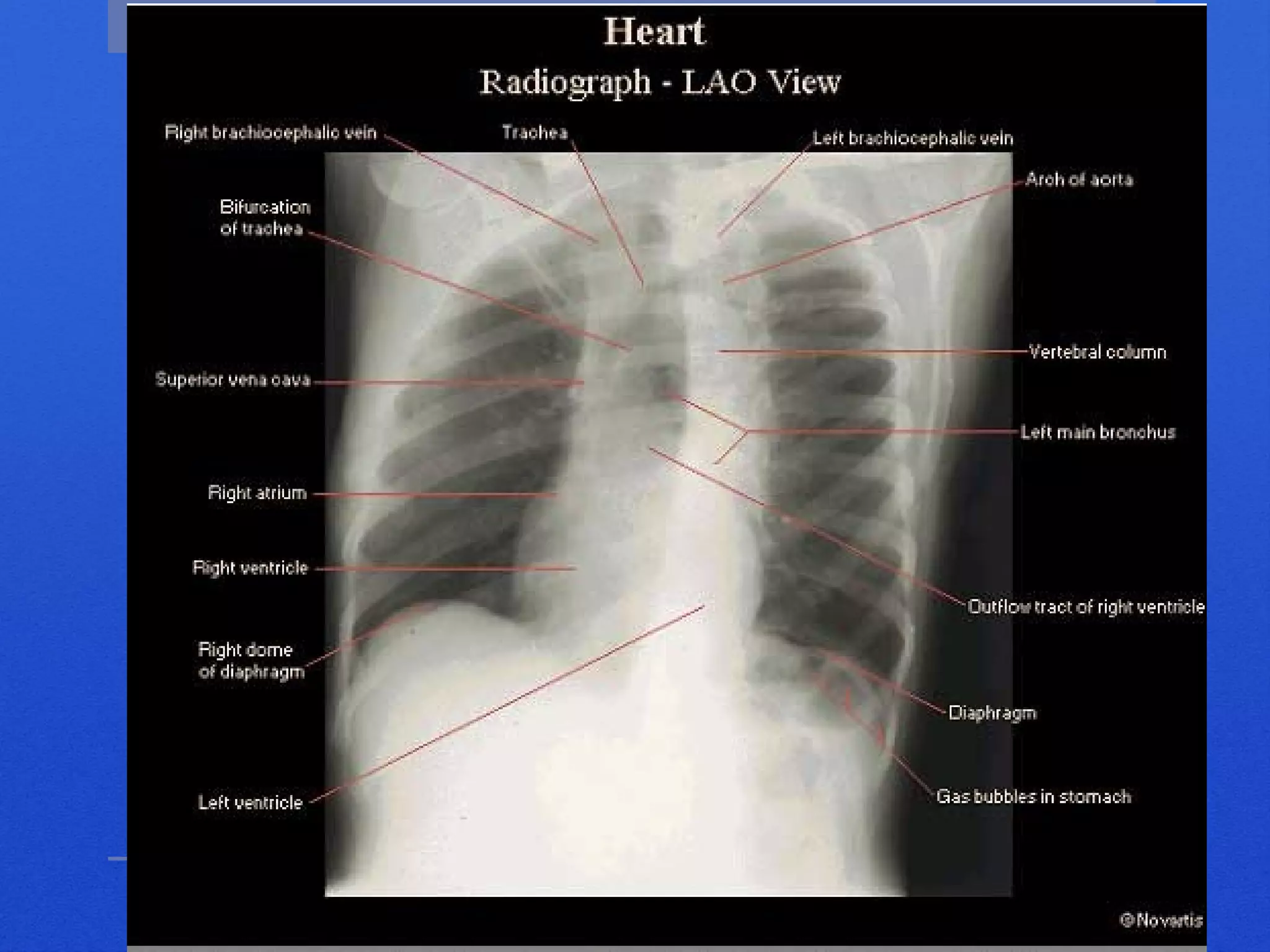 X-RAY DADA - (SISTEM RESPIRASI) | PPT