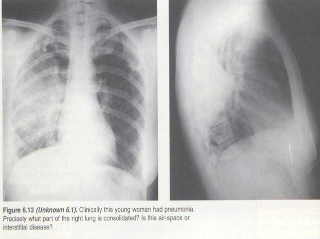 X-RAY DADA - (SISTEM RESPIRASI) | PPT
