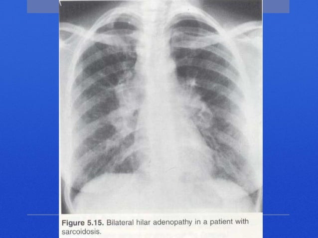 X-RAY DADA - (SISTEM RESPIRASI) | PPT