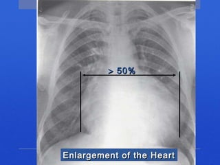 X-RAY DADA - (SISTEM RESPIRASI) | PPT