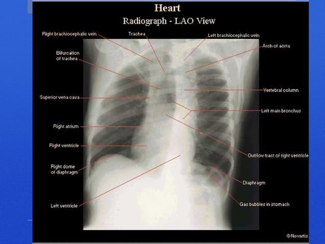 X-RAY DADA - (SISTEM RESPIRASI) | PPT