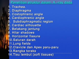 X-RAY DADA - (SISTEM RESPIRASI) | PPT