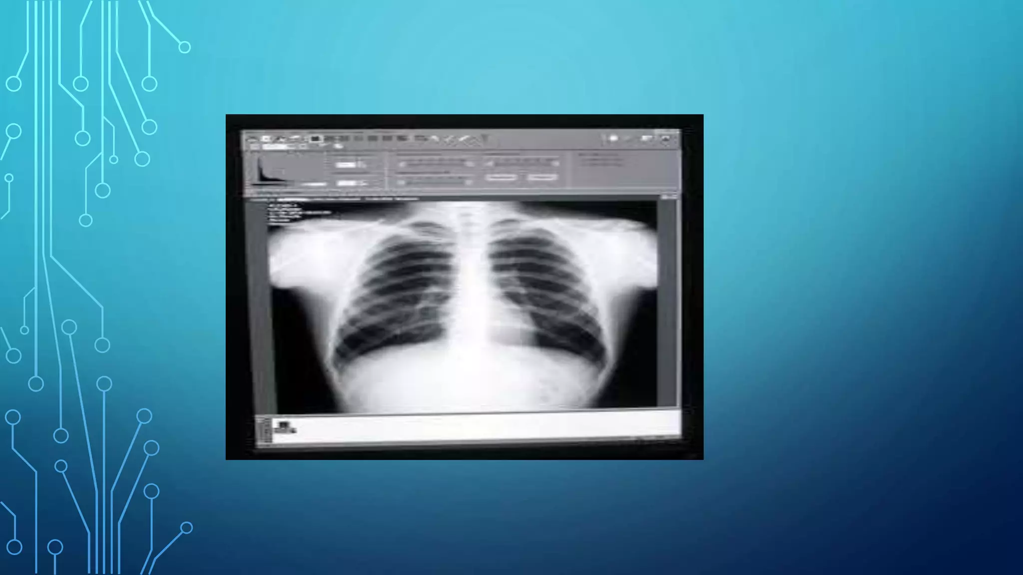X-ray diagnostic methods.pptx