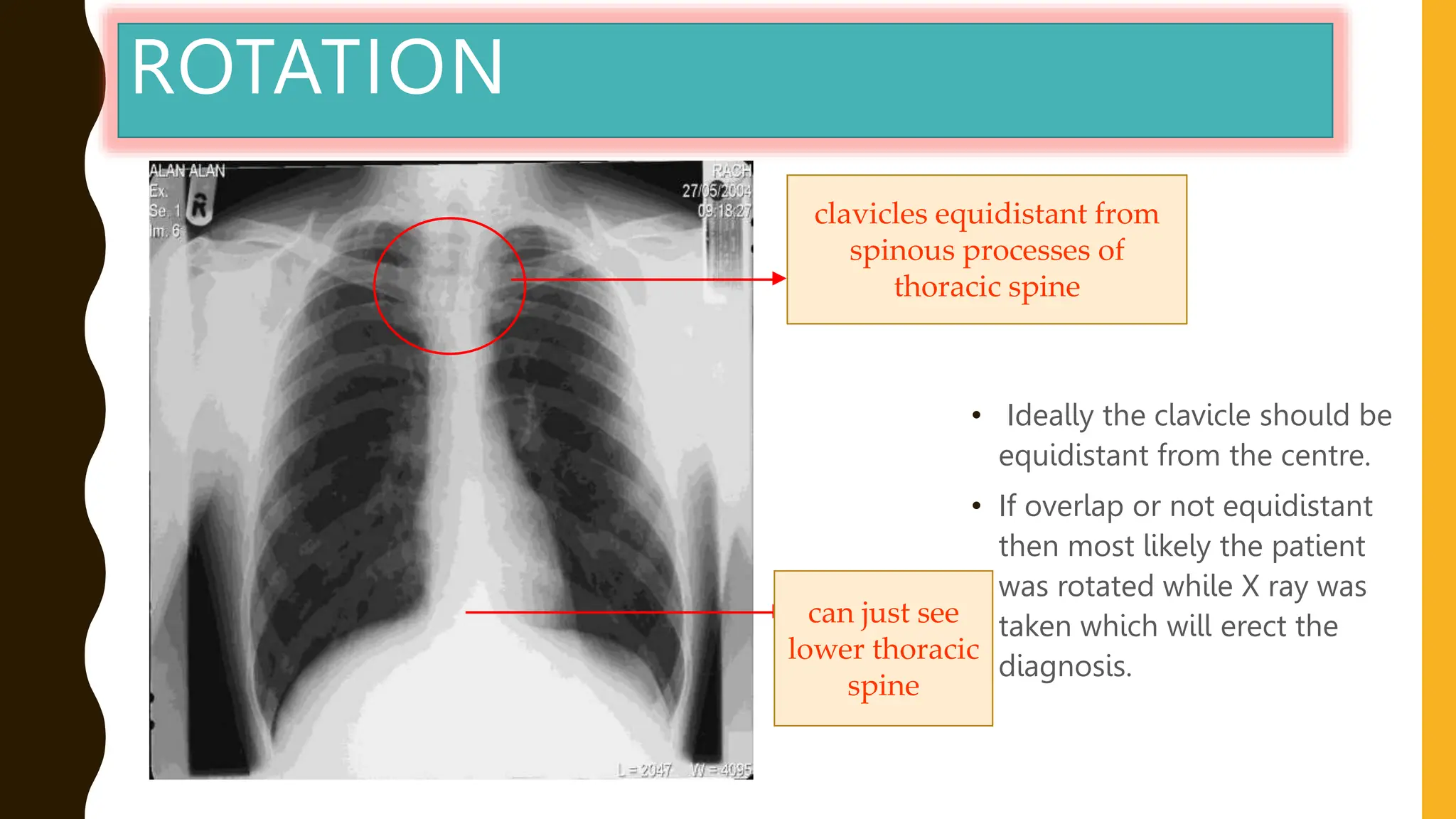 x-ray ppt made bye Dr nishant this is the best pdf to understand x ray ...