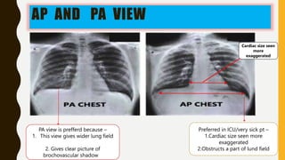 x-ray ppt made bye Dr nishant this is the best pdf to understand x ray ...