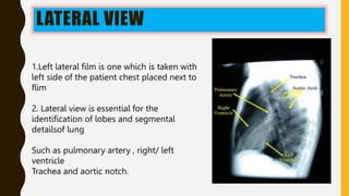 x-ray ppt made bye Dr nishant this is the best pdf to understand x ray ...