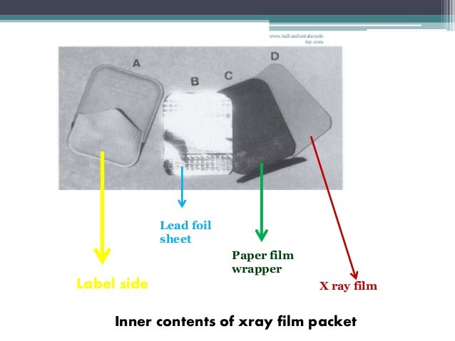 X ray film/prosthodontic courses