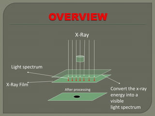 X ray film | PPTX