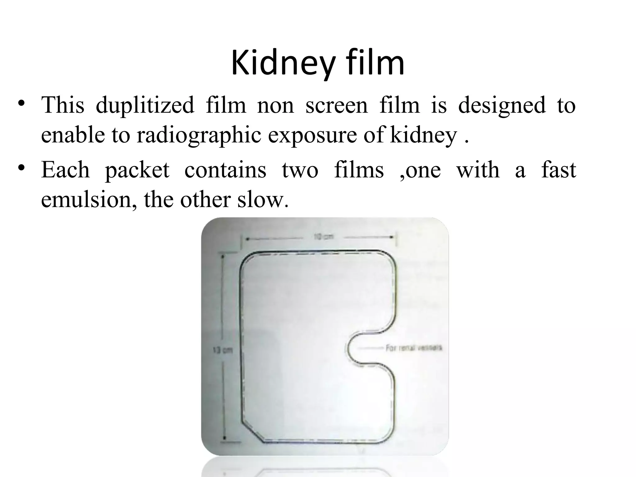 X ray films - mamita | PPT