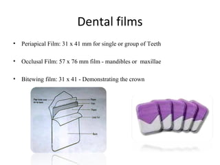 X ray films - mamita | PPT