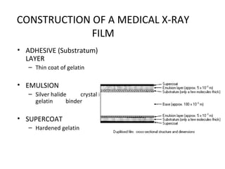 X ray films - mamita | PPT