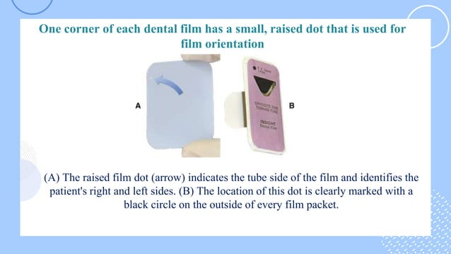 Dental X-Ray Film types and indications. | PPTX