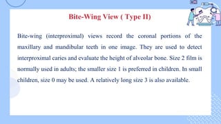 Dental X-Ray Film types and indications. | PPTX