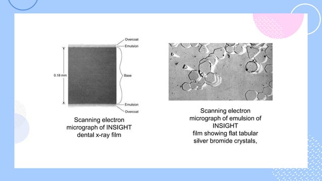 Dental X-Ray Film types and indications. | PPTX