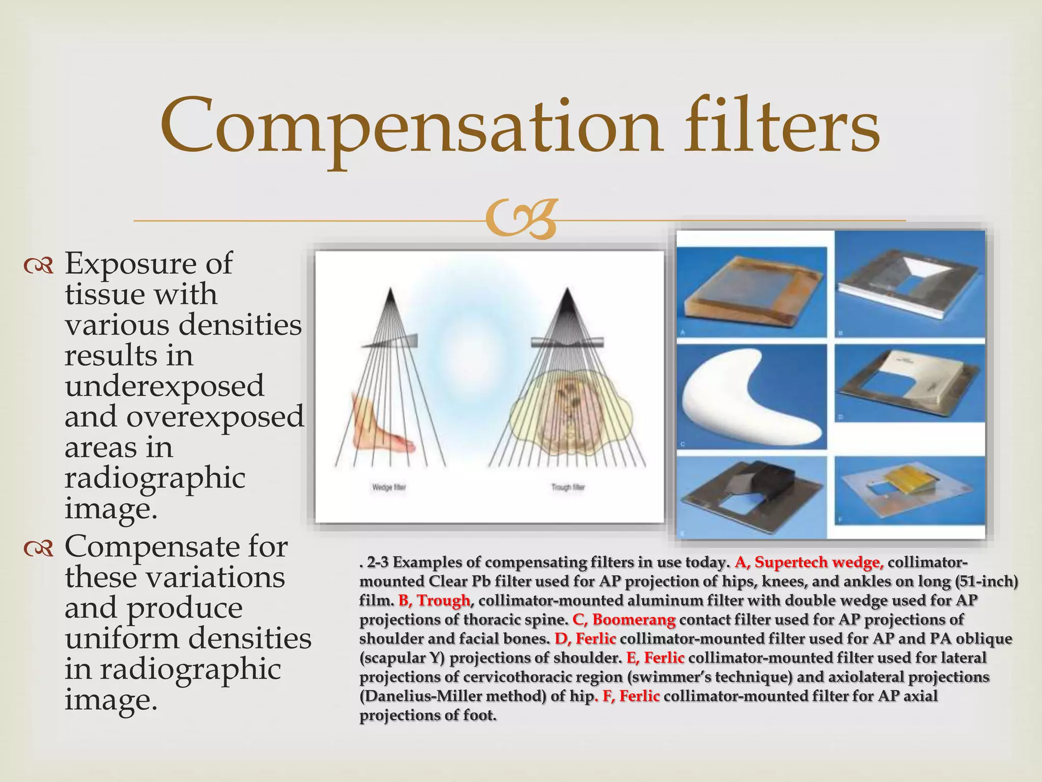 X ray filters | PPTX