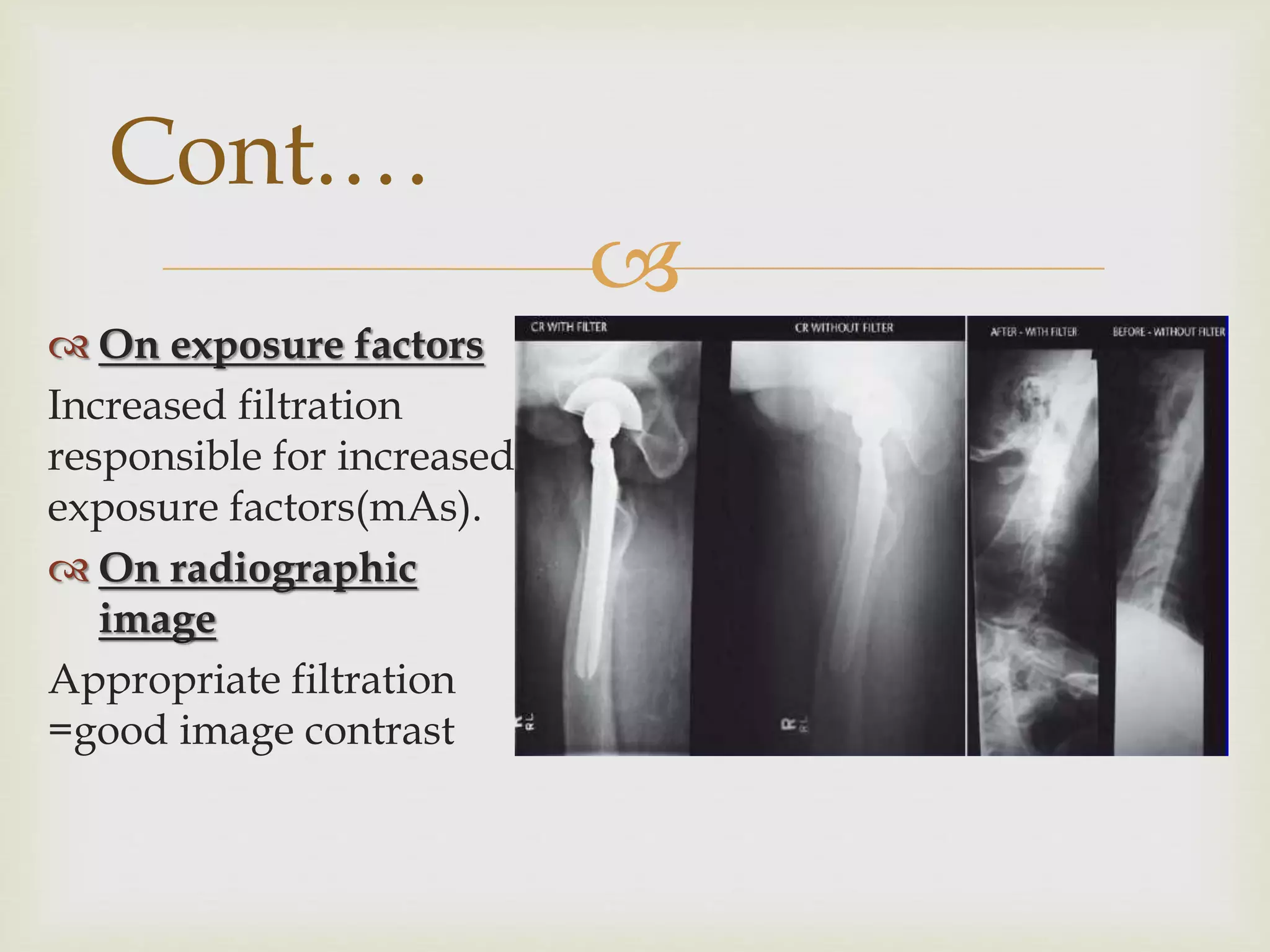 X ray filters | PPTX
