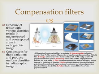 X ray filters | PPTX