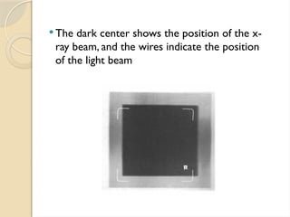 X-Ray Filters and X-Ray Beam Restrictors.pptx