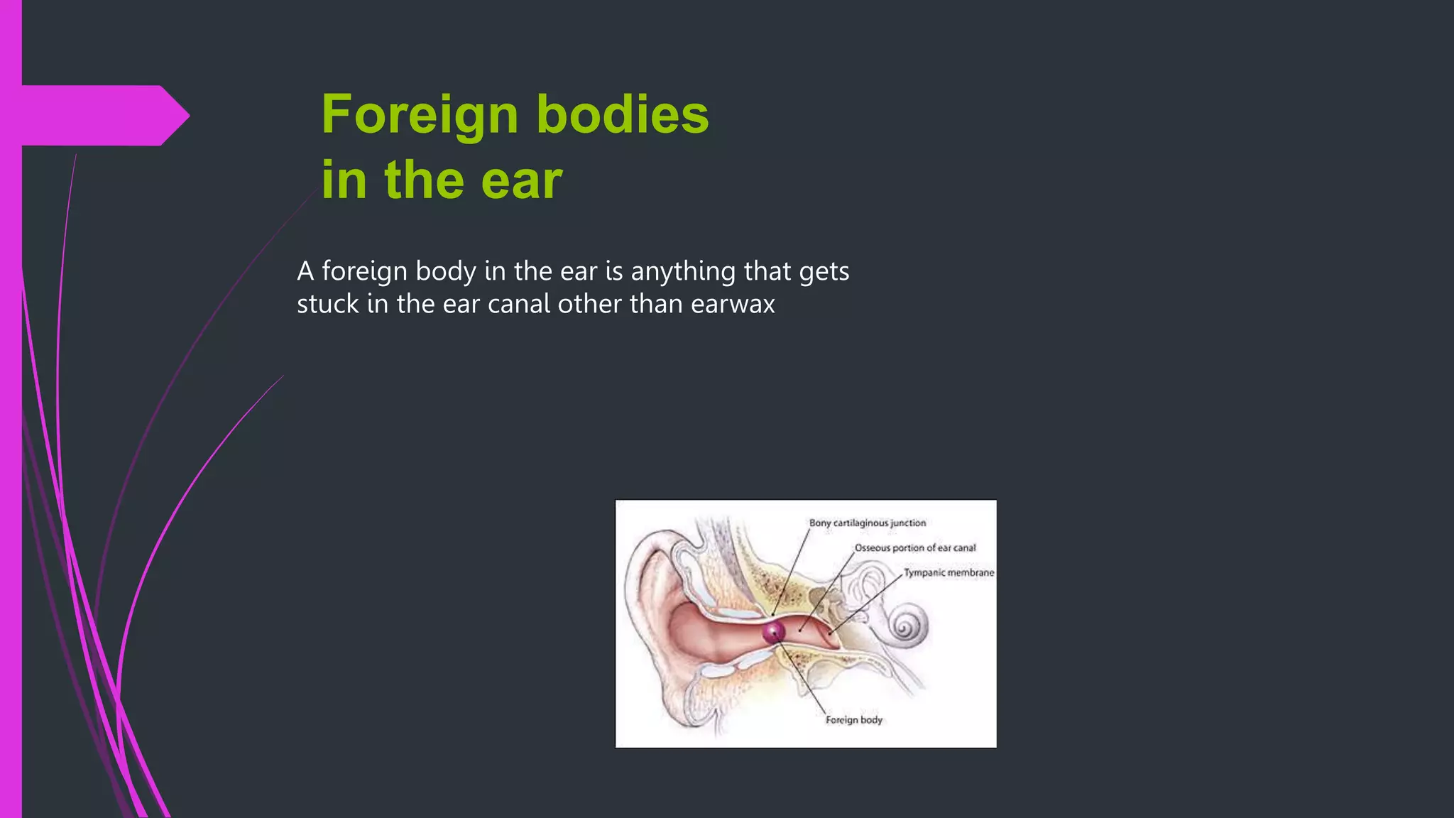 X-RAY FORIENGN BODY IN ENT.pptx