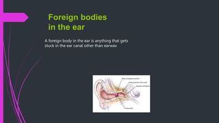 X-RAY FORIENGN BODY IN ENT.pptx
