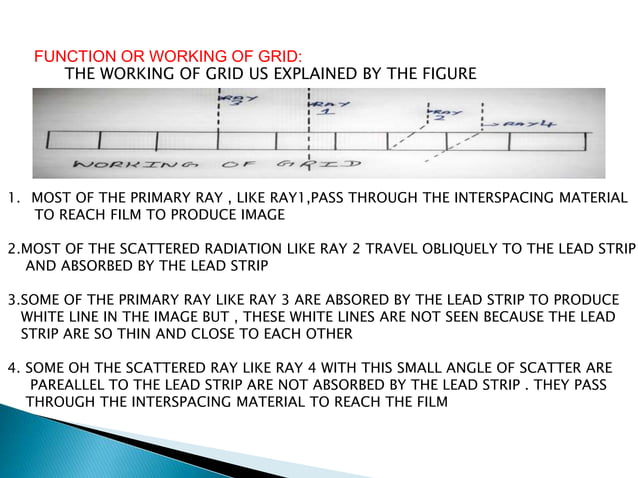 X-RAY GRID BUCKY | PPTX | Chemistry | Science
