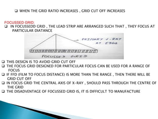 X-RAY GRID BUCKY | PPTX | Chemistry | Science
